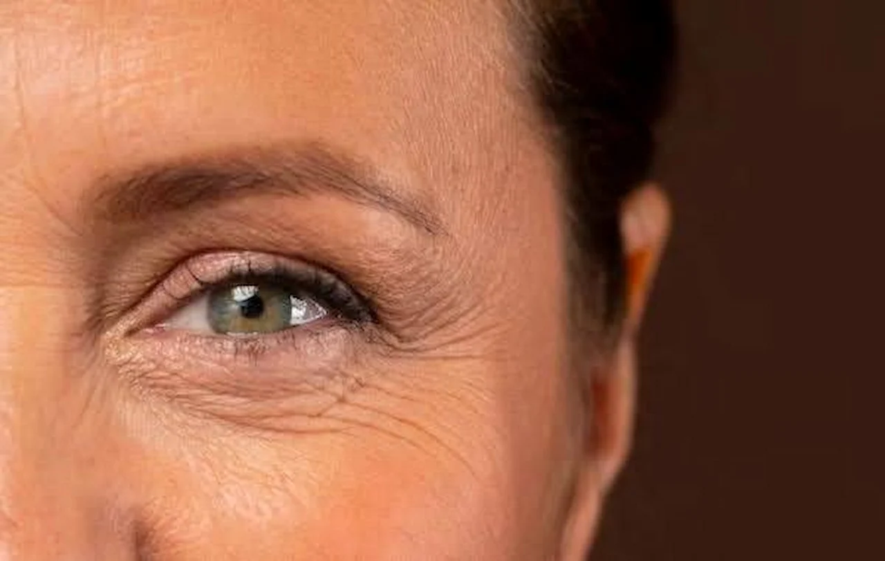 Apa itu Peeling? Mengenal Manfaat dan Efek Sampingnya