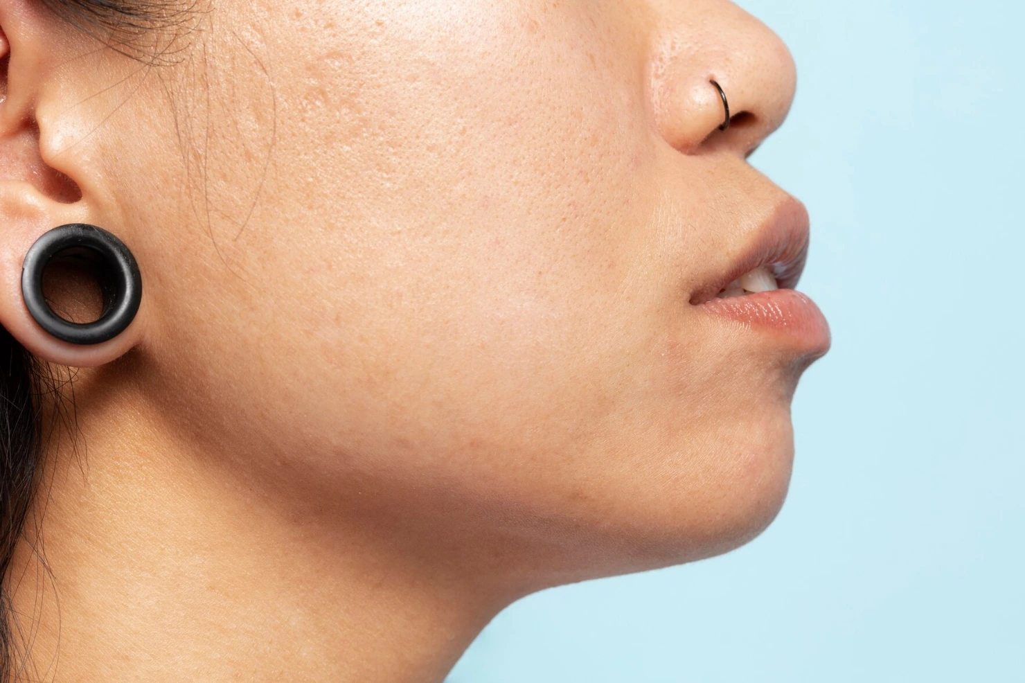 Sebaceous Filament Adalah: Penyebab dan Solusi Efektif | JAC