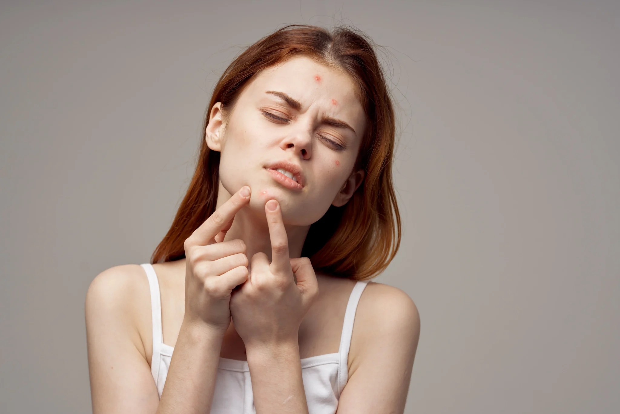 Kenali 7 Penyebab Jerawat Meradang dan Cara Atasinya