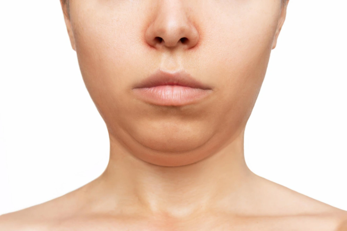 5 Penyebab Adanya Double Chin dan Tips Menghilangkannya | JAC